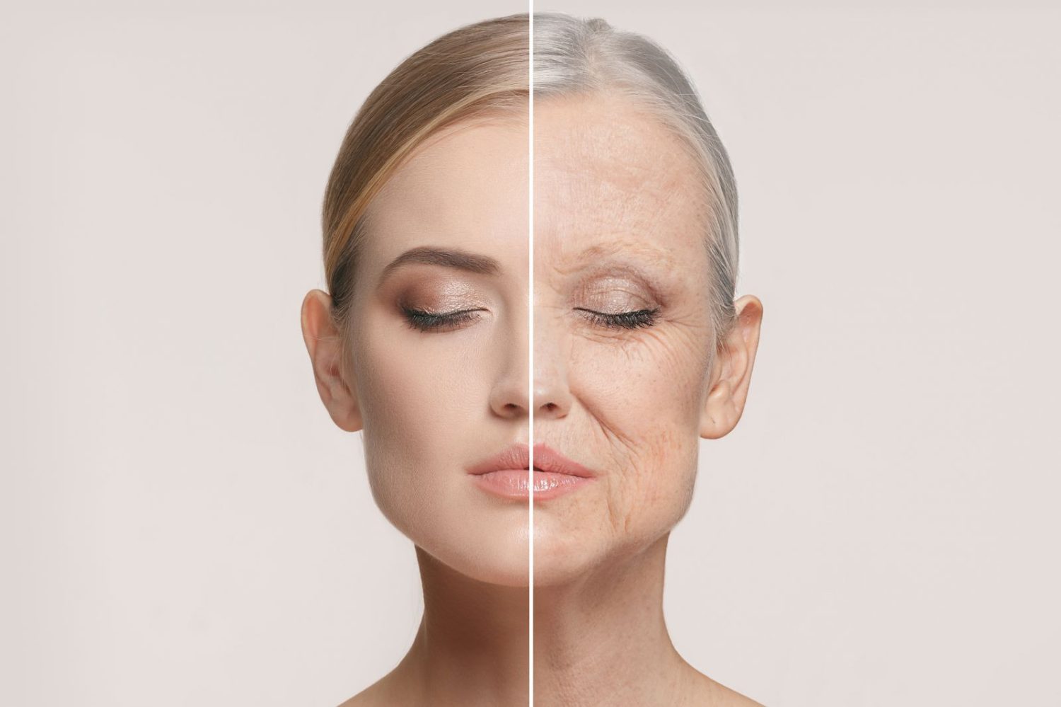 Fine Lines + Wrinkles + Volume | Brisbane Skin, Dermatologist Brisbane ...